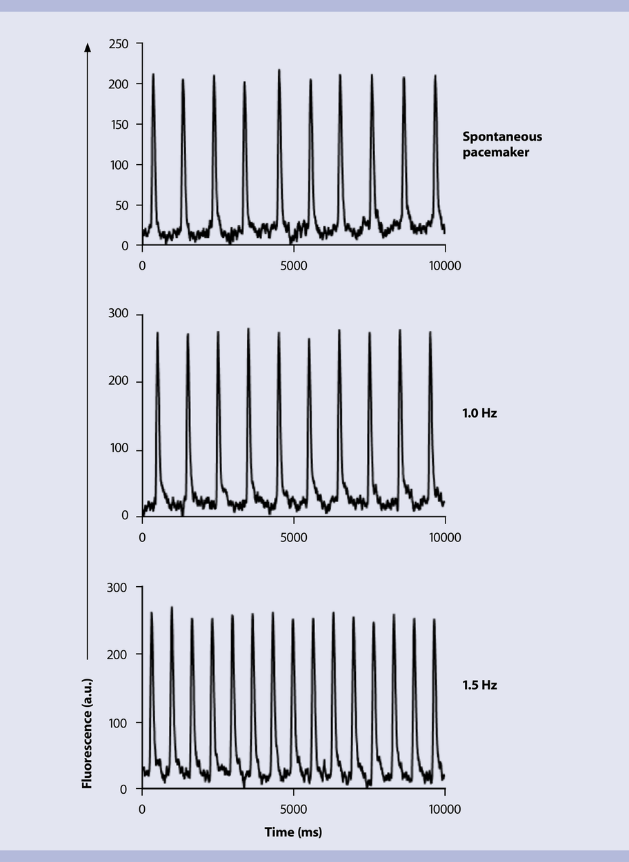 Differentiation of cardiomyocytes | Human PSCs | Protocol | Miltenyi ...