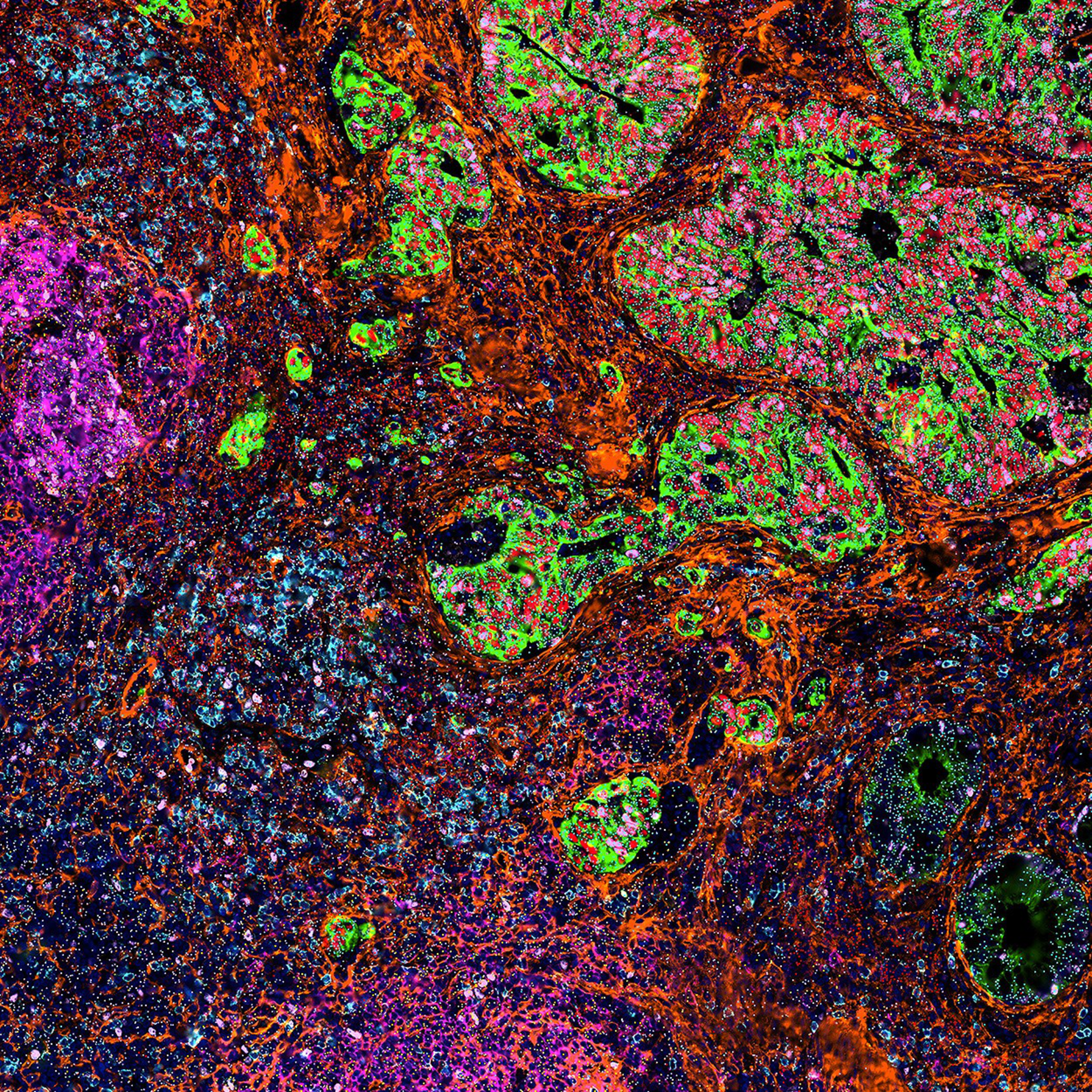 Custom RNA panels for spatial multiomics | Miltenyi Biotec | Great Britain