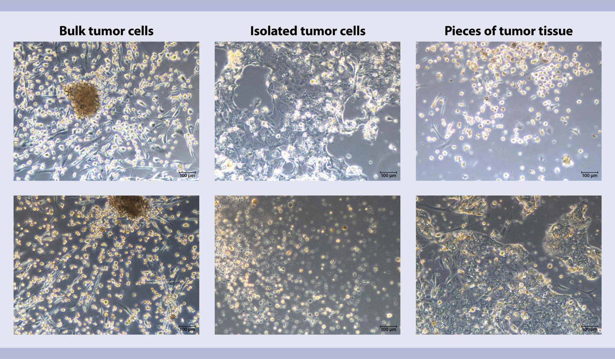 Initiation of human tumor cell culture from primary tumors | Miltenyi ...