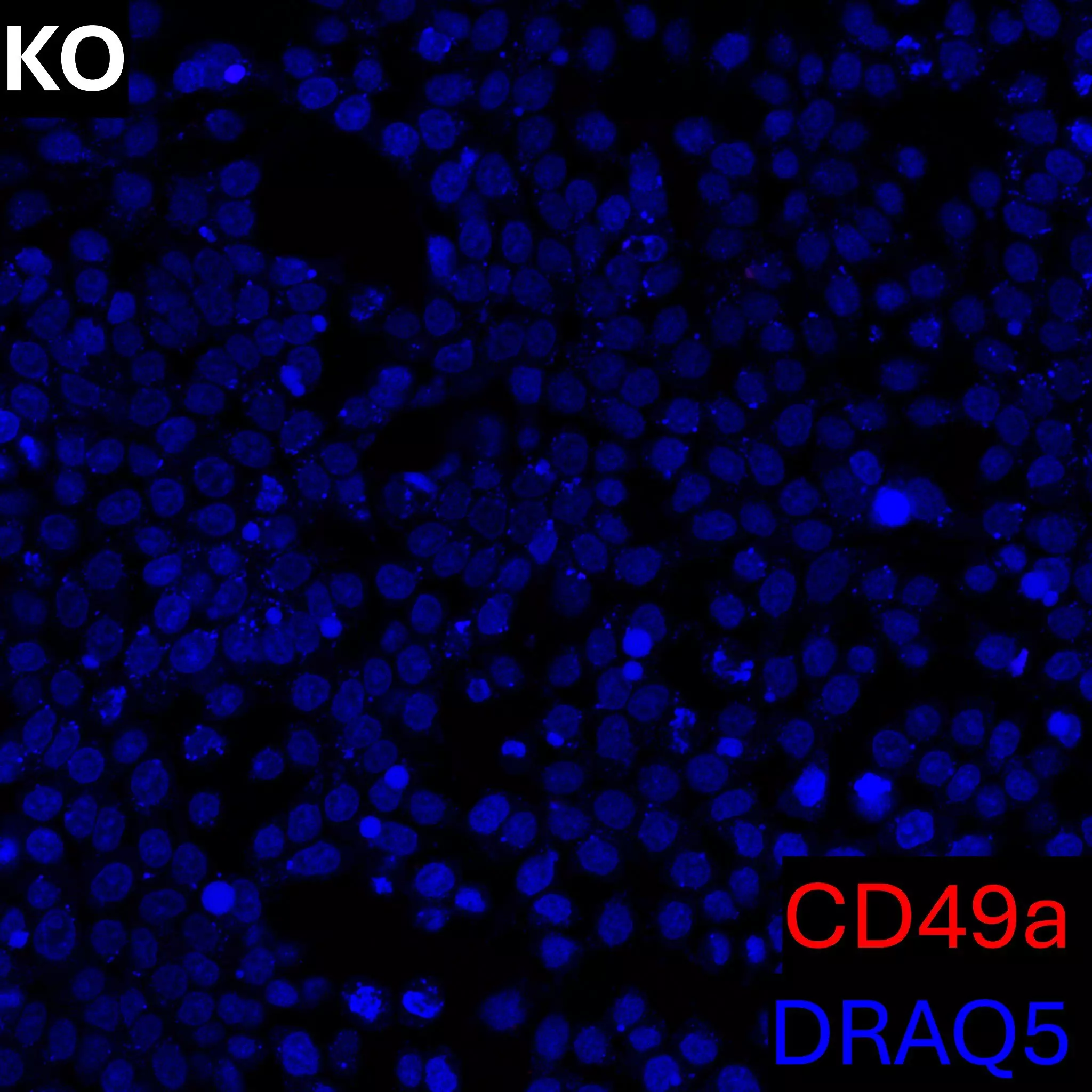 CD49a Antibody, anti-human, REAfinity™ | Miltenyi Biotec | France