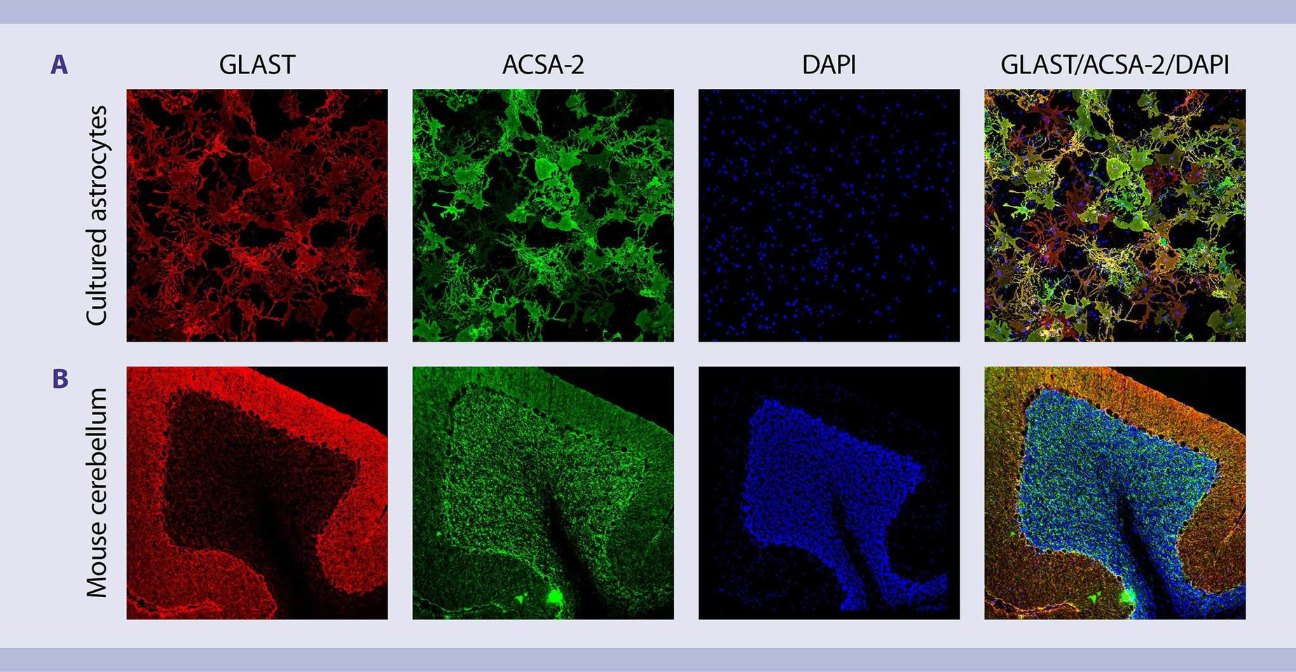 Astrocytes | Astrocyte Culture Isolation Characterization ...