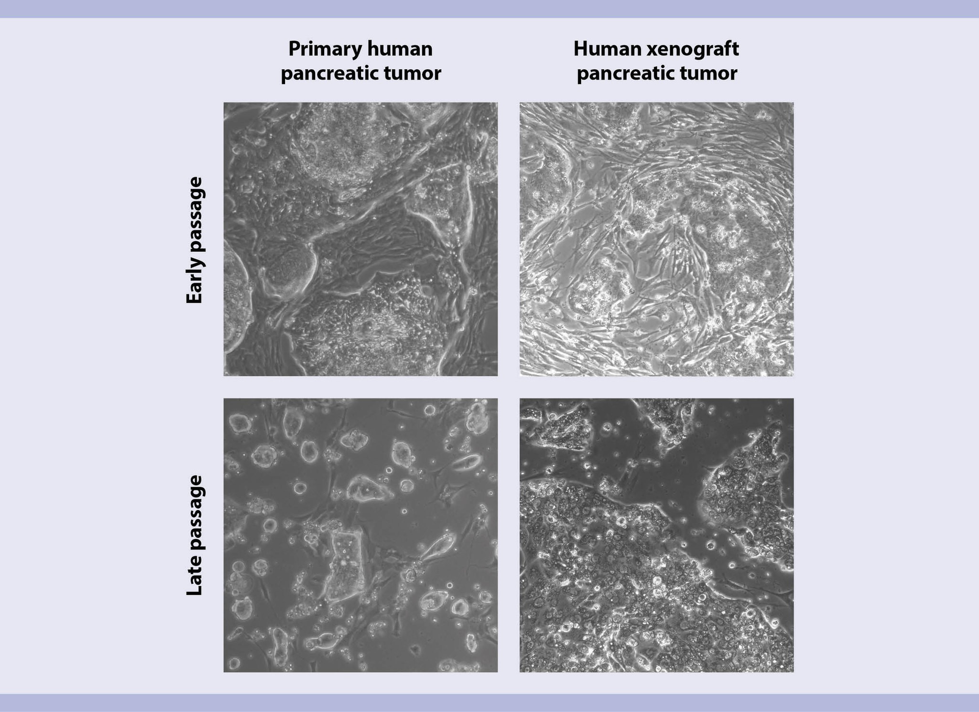 Tumor tissue storage | Tumor tissue dissociation | Miltenyi | Miltenyi ...