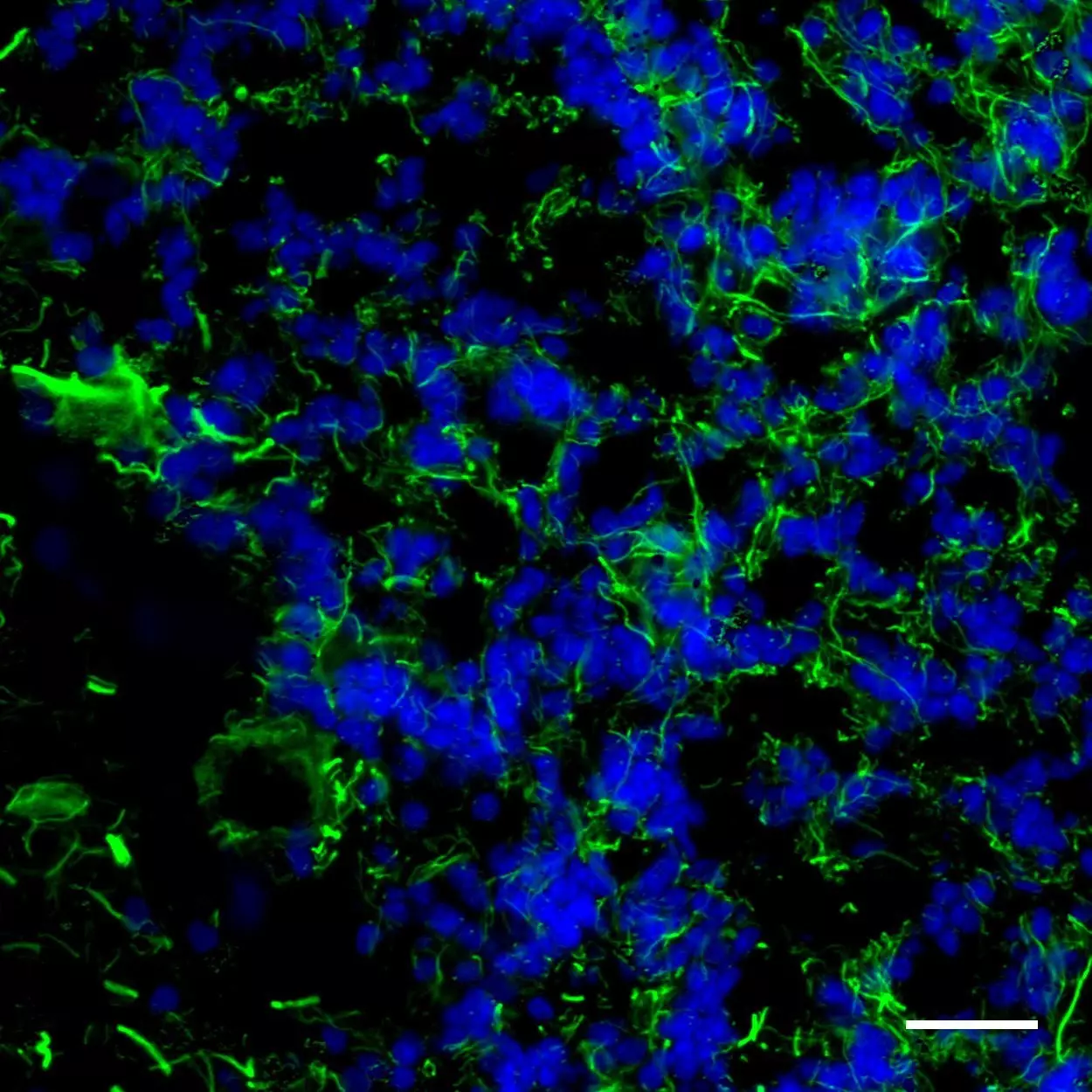 Neurofilament M (160 kD) Antibody, anti-human/mouse, REAdye_lease ...