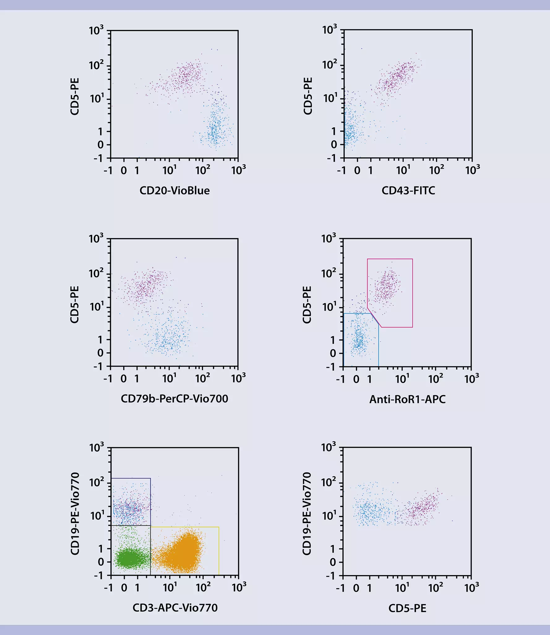 B cell malignancies | B cell isolation protocol | Miltenyi | Miltenyi ...
