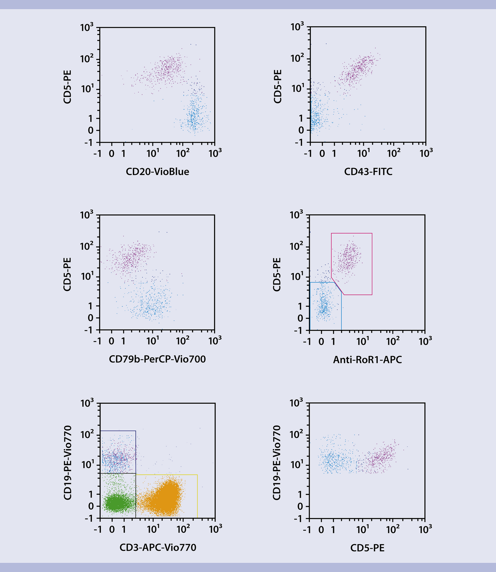 B cell malignancies | B cell isolation protocol | Miltenyi | Miltenyi ...