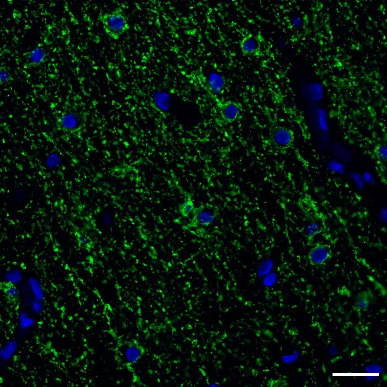 SLC12A5 (KCC2) Antibody, anti-human, REAdye_lease™ | Miltenyi Biotec | USA