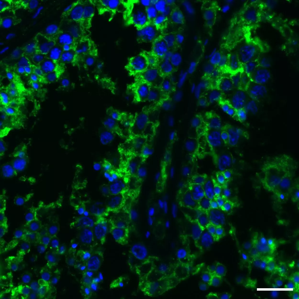 TRA-1-85 (CD147) Antibody, anti-human, REAdye_lease™ | Miltenyi Biotec ...