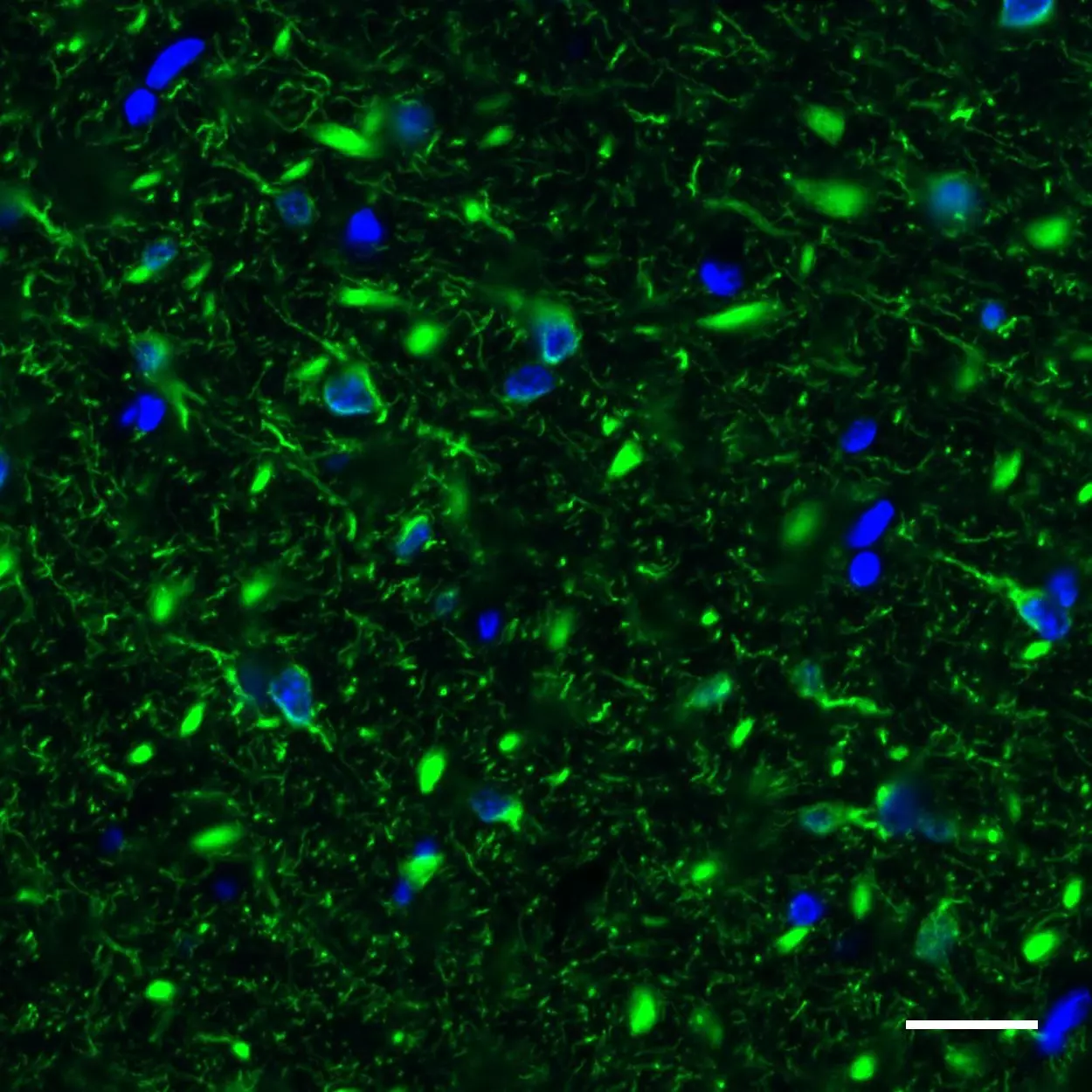 MAP2 Antibody, anti-human/mouse, REAdye_lease™ | Miltenyi Biotec | USA