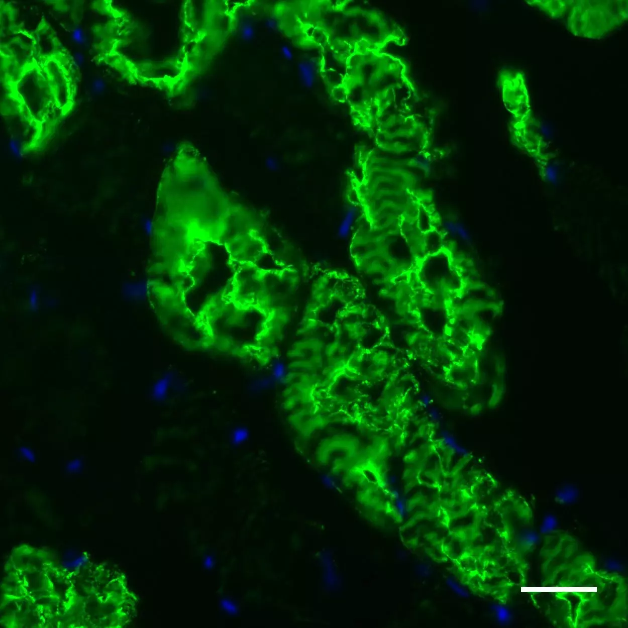 MYH7B Antibody, anti-human, REAdye_lease™ | Miltenyi Biotec | USA