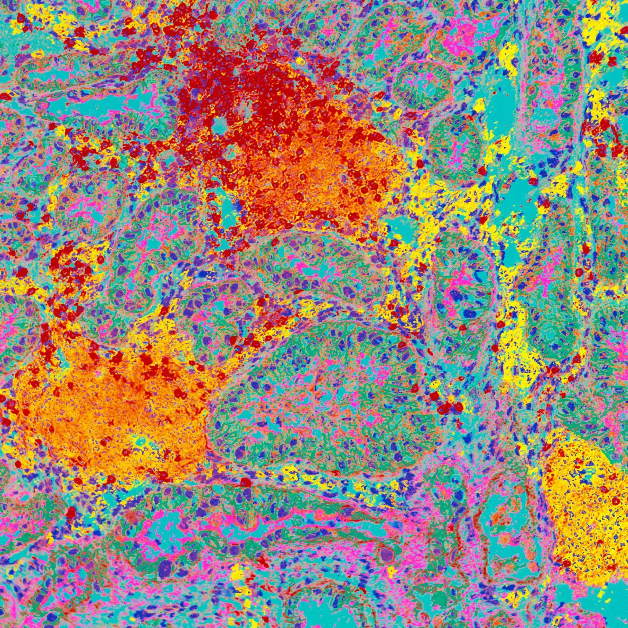 Spatial biology | MACSima™ Platform | Multiplex Imaging | Miltenyi ...