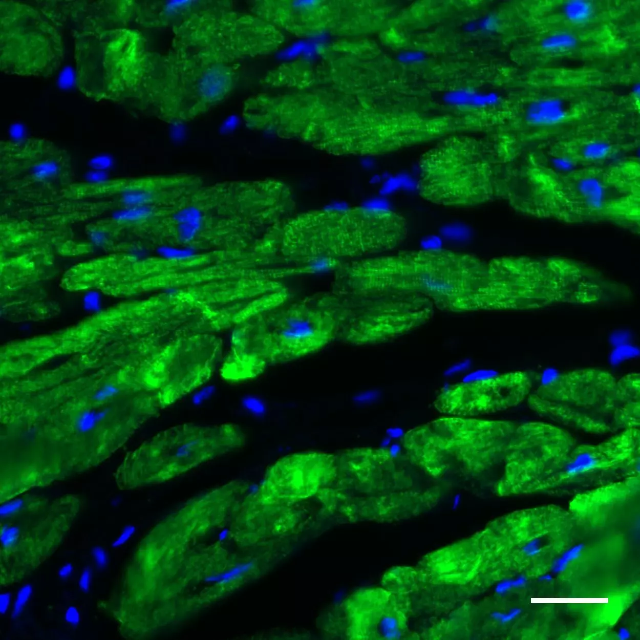 ACTC1 Antibody, anti-human, REAdye_lease™ | Miltenyi Biotec | USA
