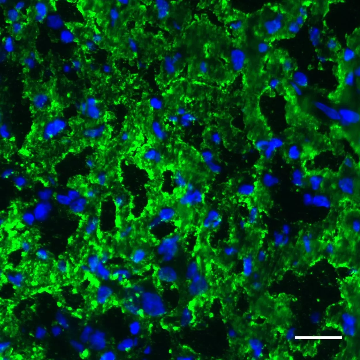 Ganglioside GD2 Antibody, anti-human, REAdye_lease™ | Miltenyi Biotec ...