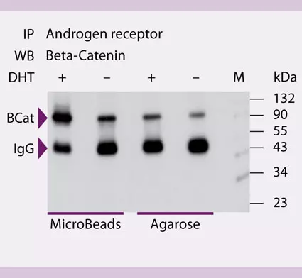 Protein A or Protein G Kits | Miltenyi Biotec | USA