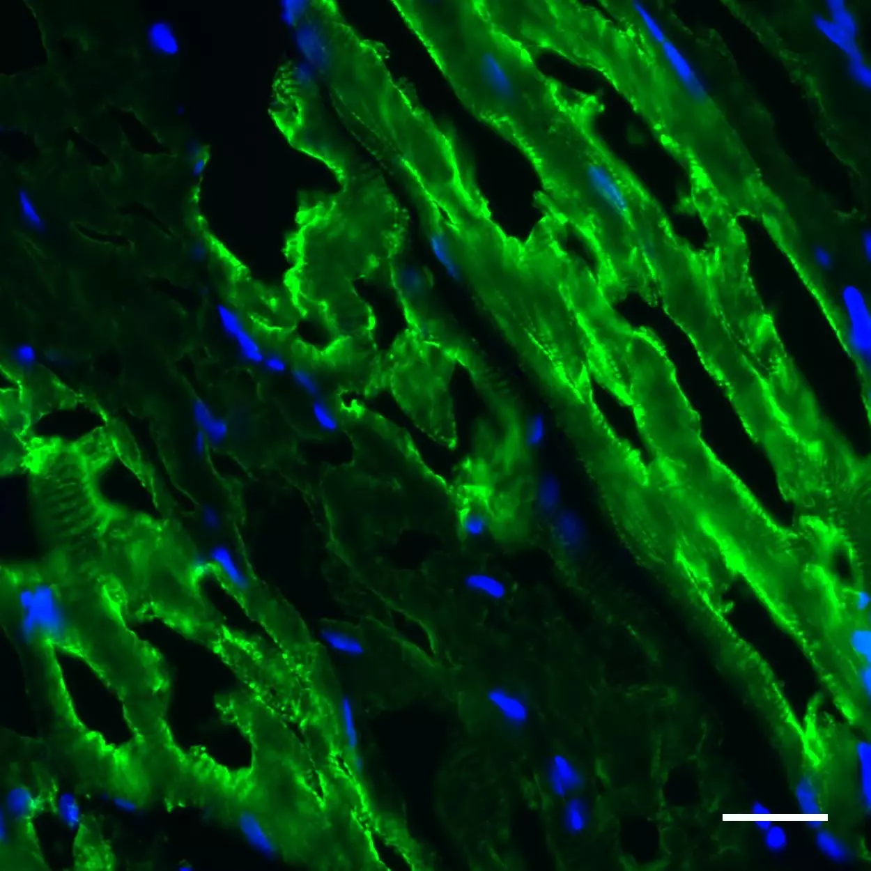 MYH7B Antibody, anti-human, REAdye_lease™ | Miltenyi Biotec | USA