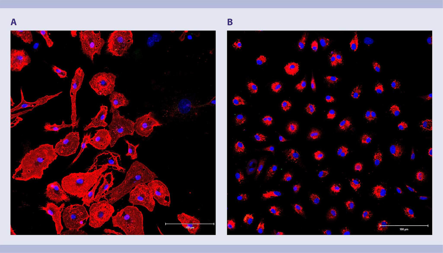 Neural cells (mouse) | Miltenyi Biotec | USA
