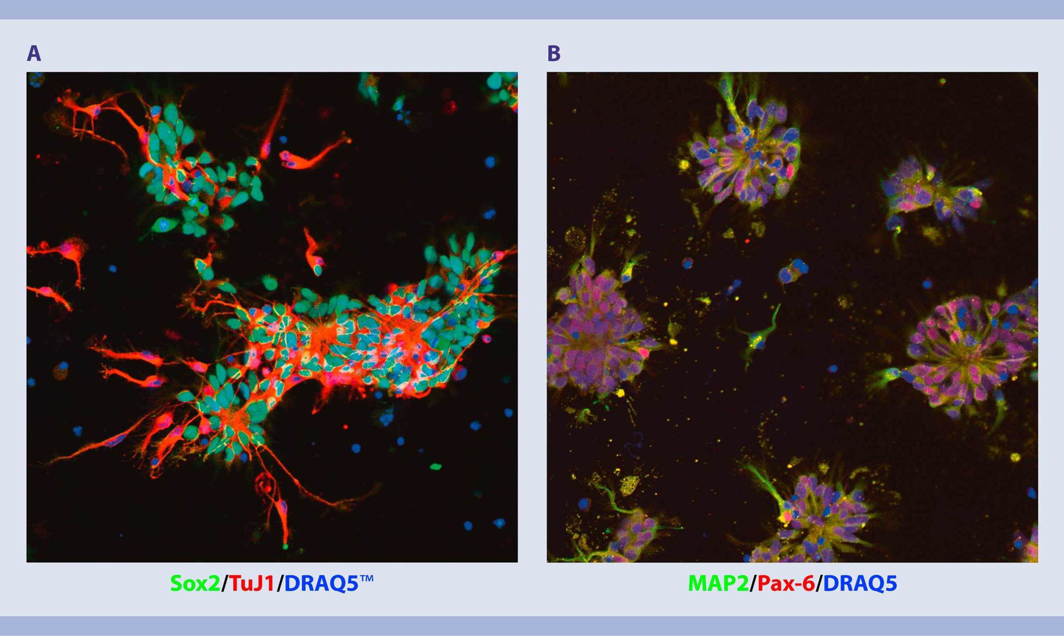 PSC-derived cerebral organoids | Protocol | Miltenyi Biotec | 대한민국