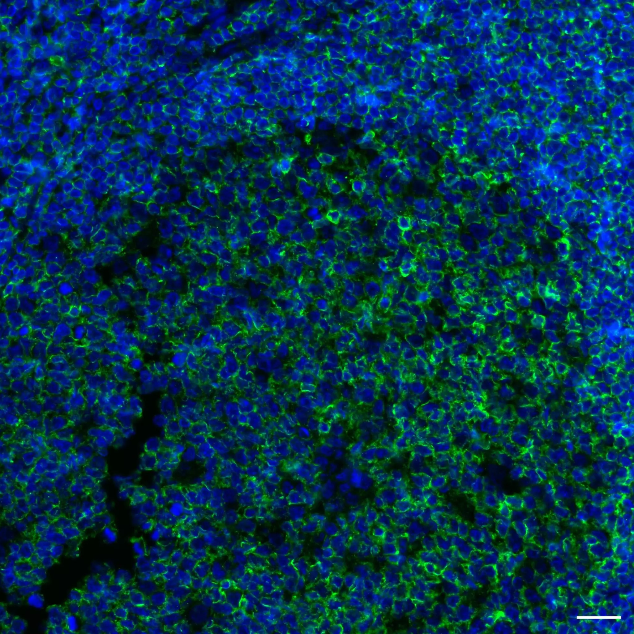 CD45 Antibody, anti-human, REAfinity™ | Miltenyi Biotec | India