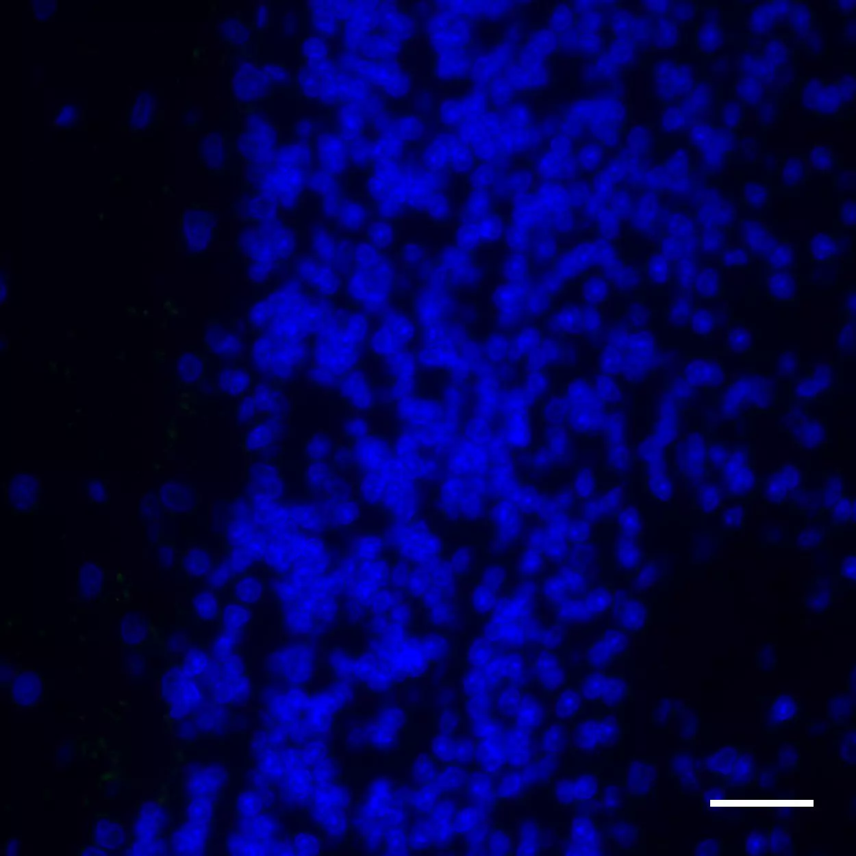 Neurofilament H (200 kD) Antibody, anti-human/mouse, REAdye_lease ...