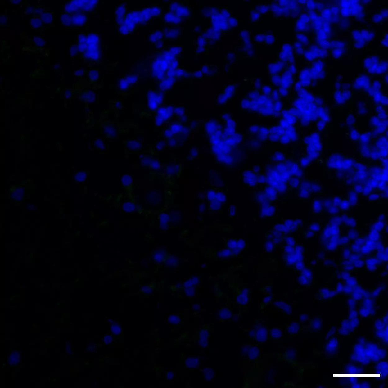 Neurofilament H (200 kD) Antibody, anti-human/mouse, REAdye_lease ...
