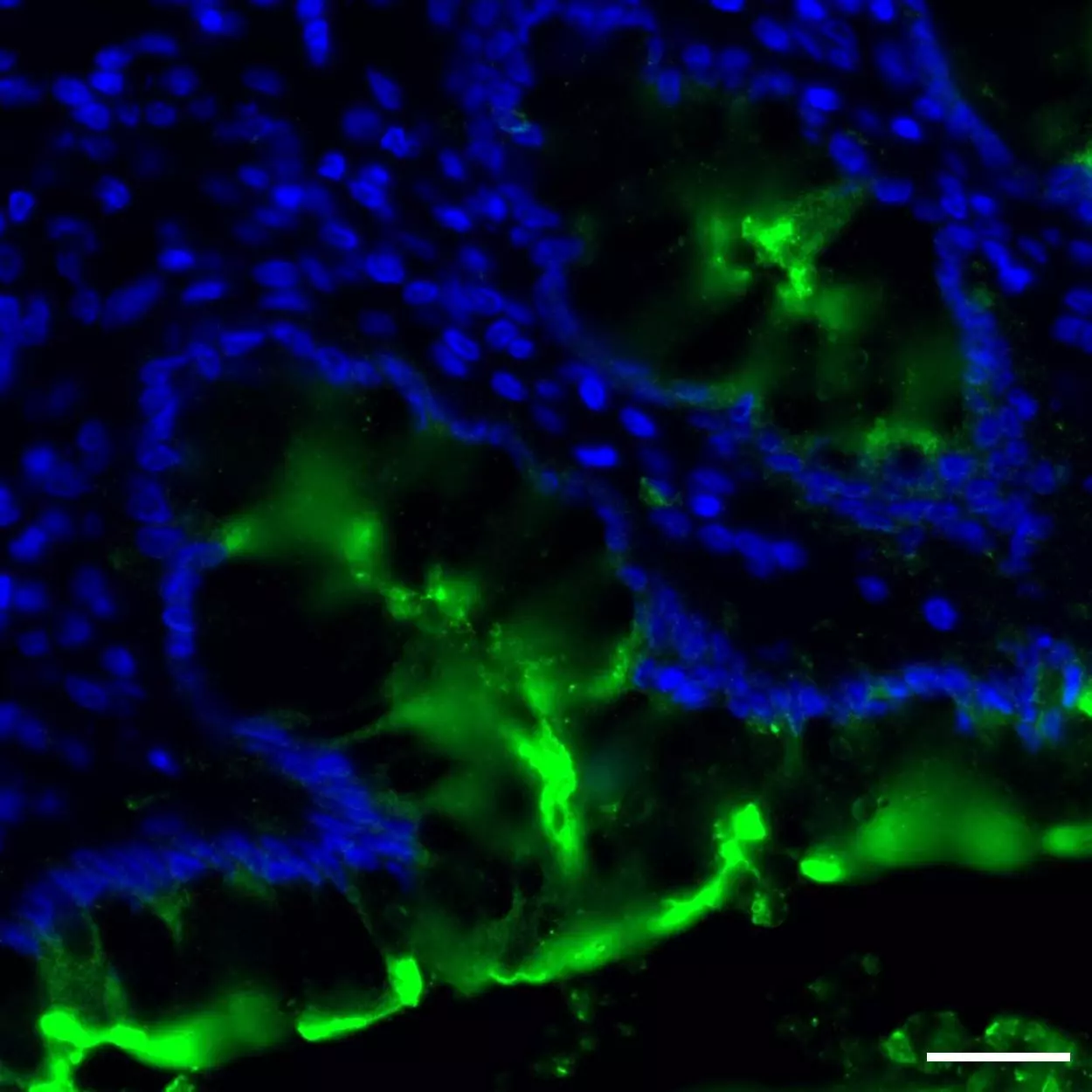 CD66e (CEACAM5) Antibody, anti-human, REAfinity™ | Miltenyi Biotec | USA