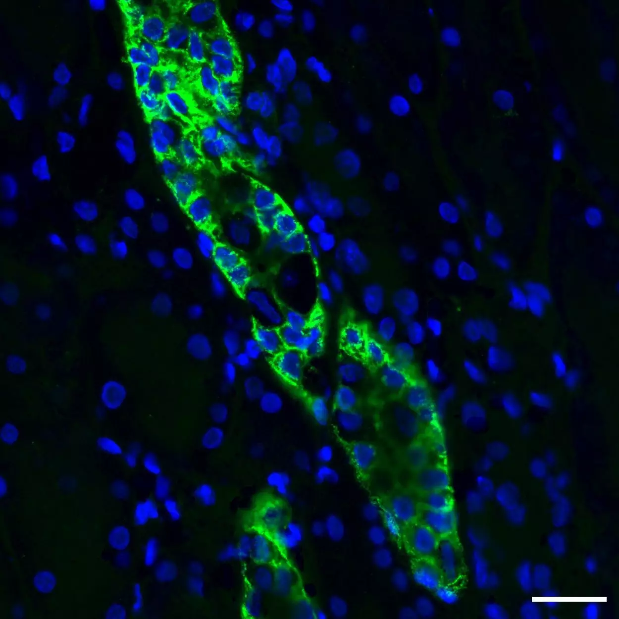 CD171 (L1CAM) Antibody, anti-human, REAdye_lease™ | Miltenyi Biotec ...