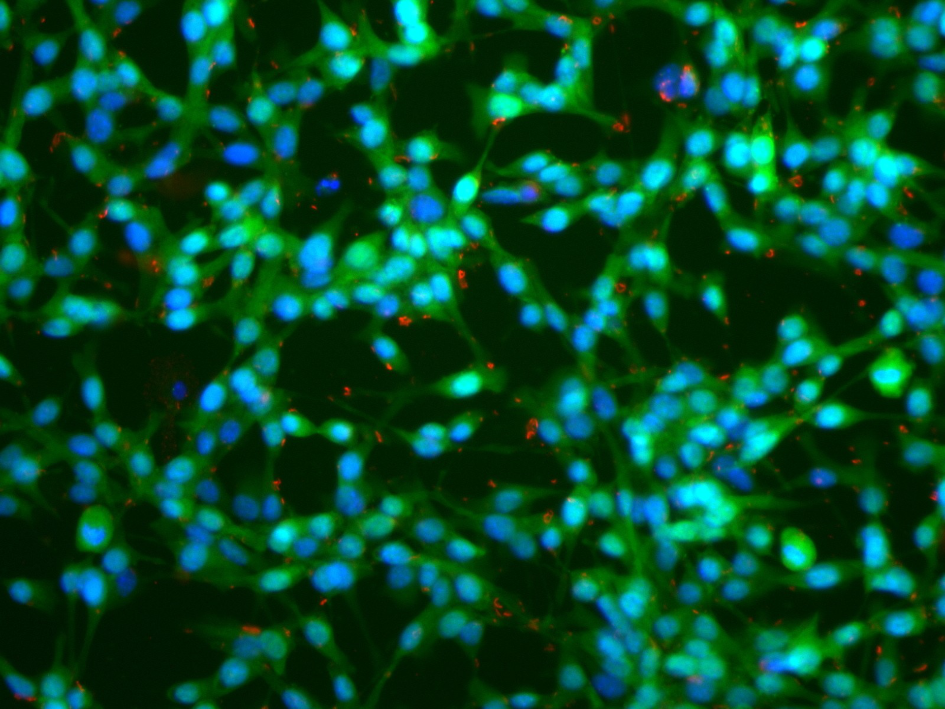 Tumor cells (mouse) | Miltenyi Biotec | 日本