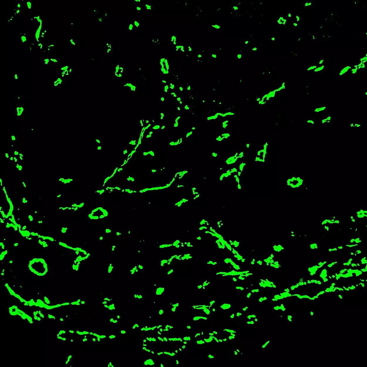 CD144 (VE-Cadherin) Antibody, anti-human, REAfinity™ | Miltenyi Biotec ...