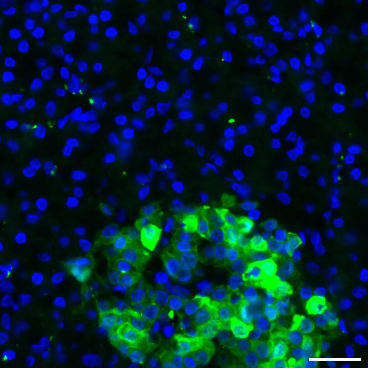 Enolase 2 (NSE) Antibody, anti-human, REAfinity™ | Miltenyi Biotec ...
