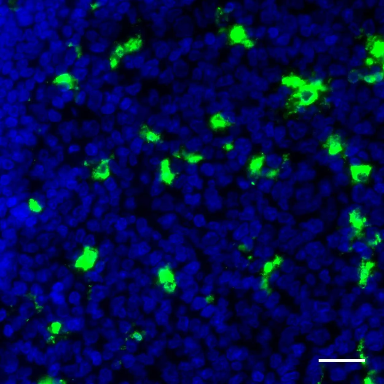 CD68 Antibody, anti-human, REAfinity™ | Miltenyi Biotec | 대한민국