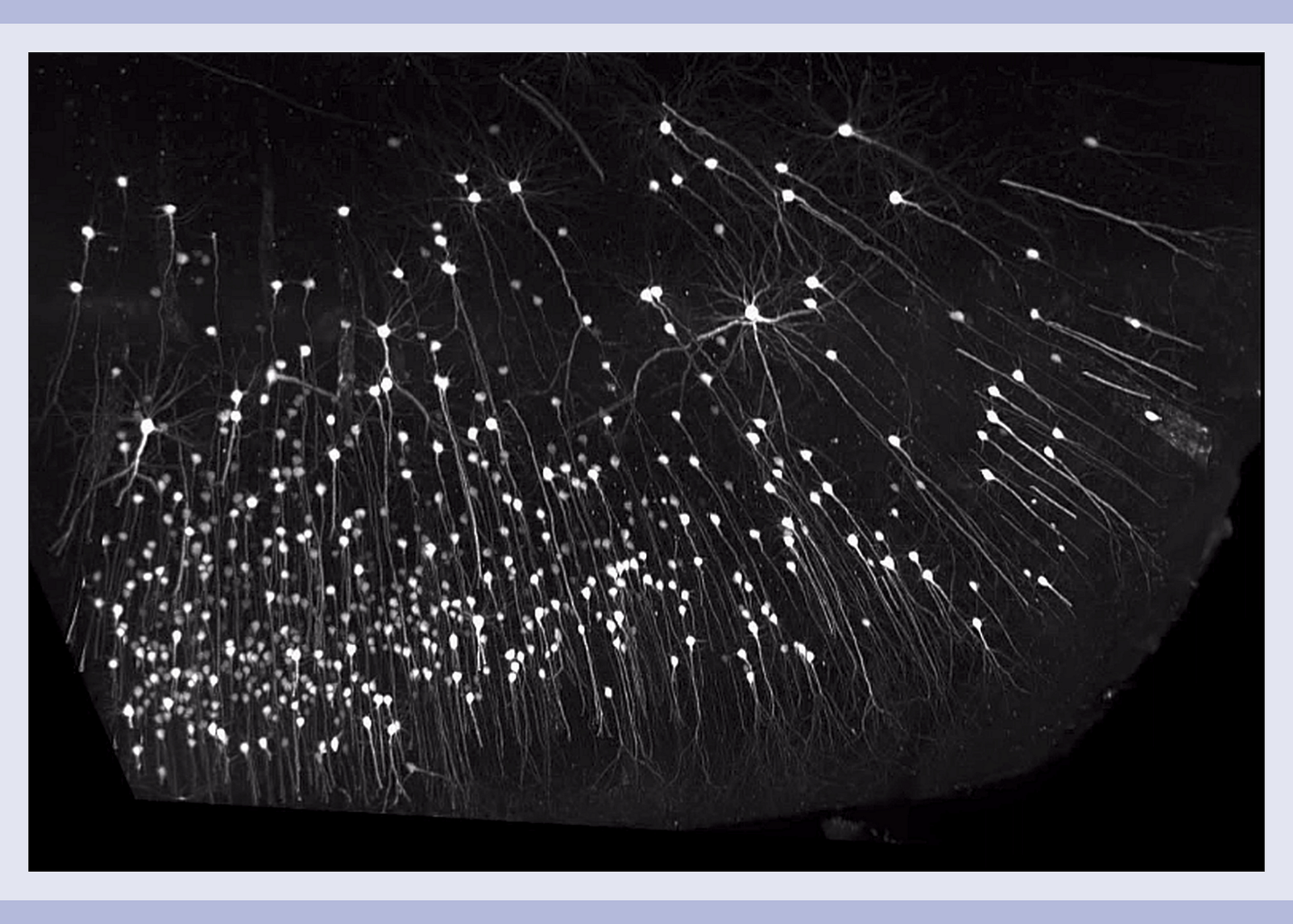 LightSpeed Mode for UltraMicroscope Blaze™ – Faster than ever, precise ...