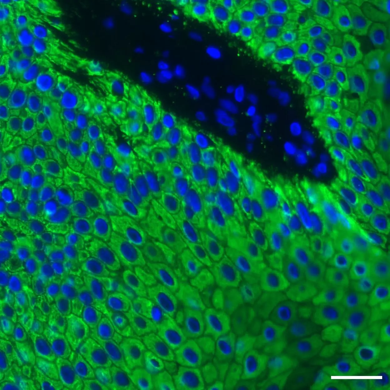 Cytokeratin 14 Antibody, anti-human, REAfinity™ | Miltenyi Biotec | 대한민국
