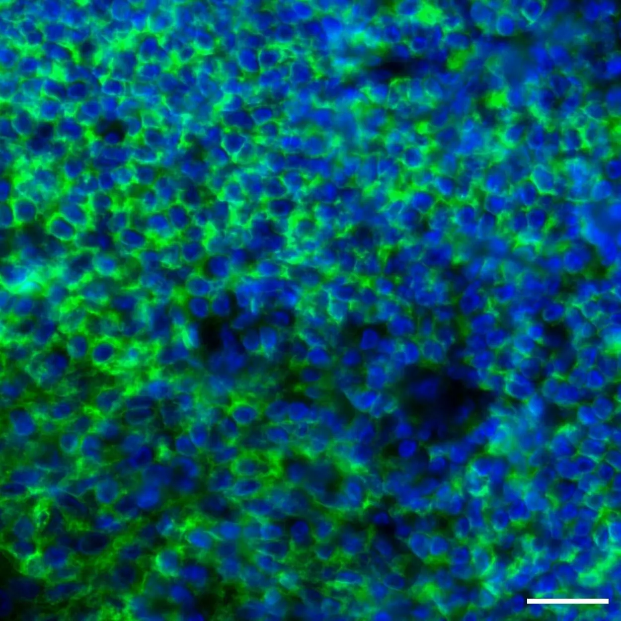 HLA-ABC Antibody, anti-human, REAdye_lease™ | Miltenyi Biotec | Great ...