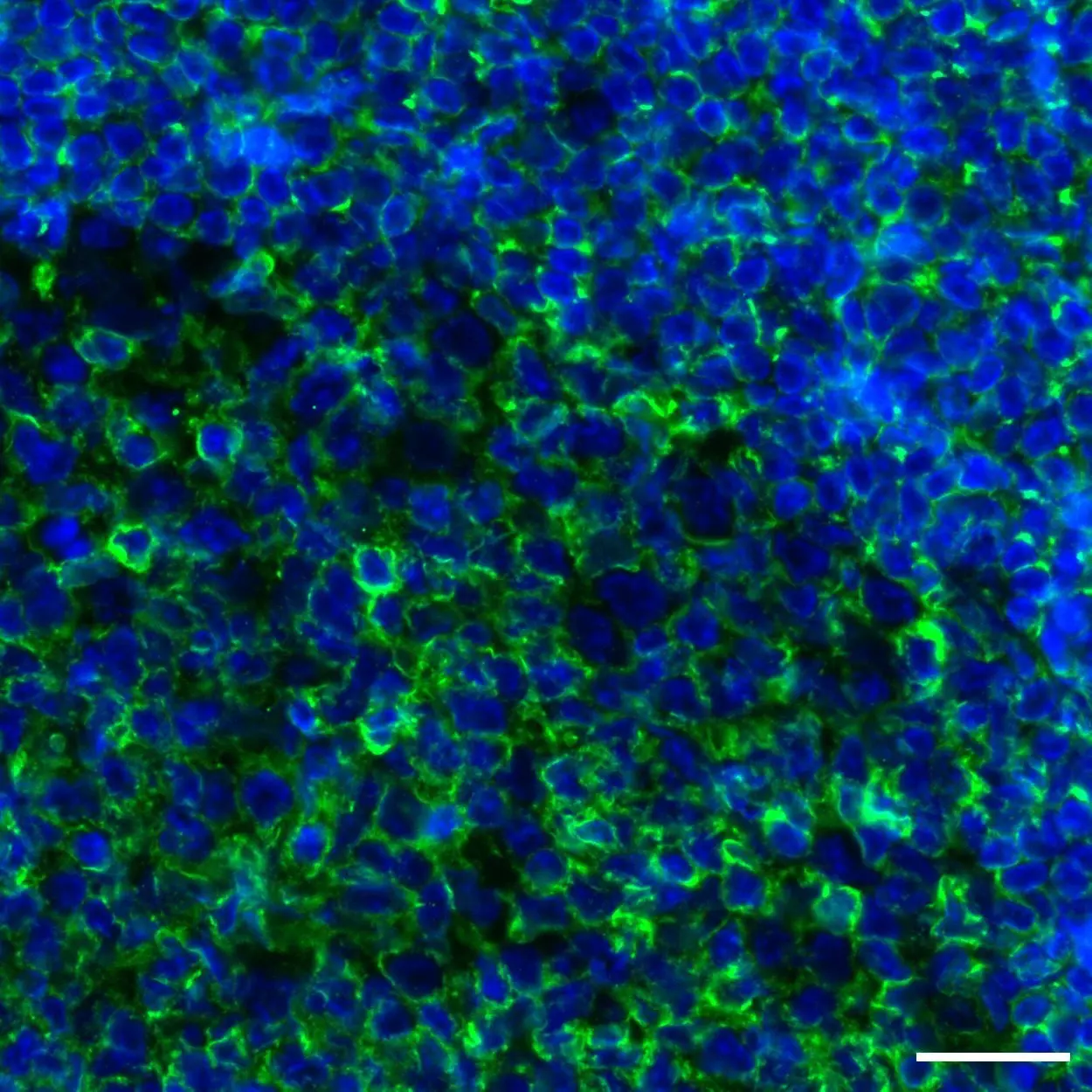 CD45 Antibody, anti-human, REAfinity™ | Miltenyi Biotec | India