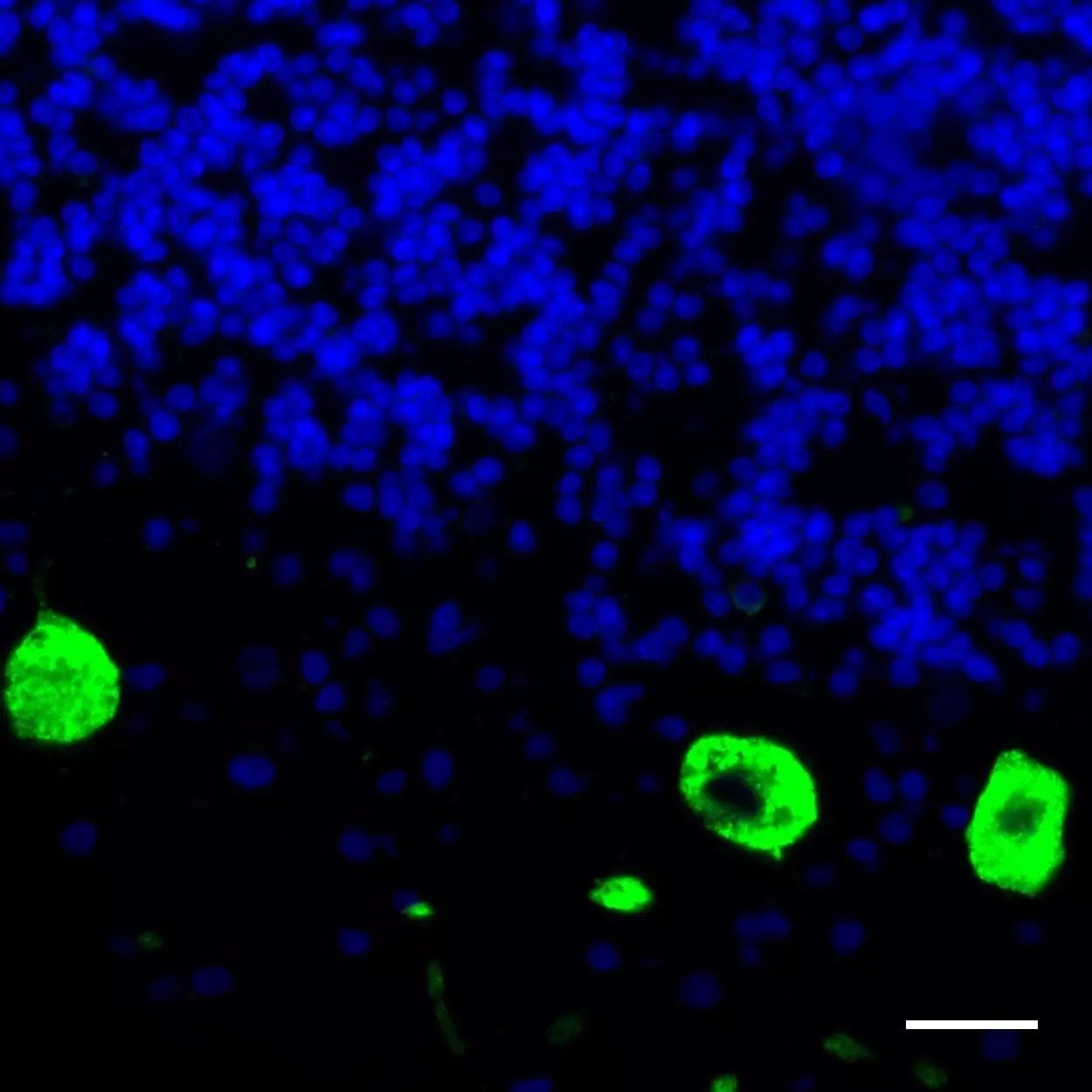 Nicotinic Acetylcholine Receptor Antibody, anti-human/mouse, REAdye ...