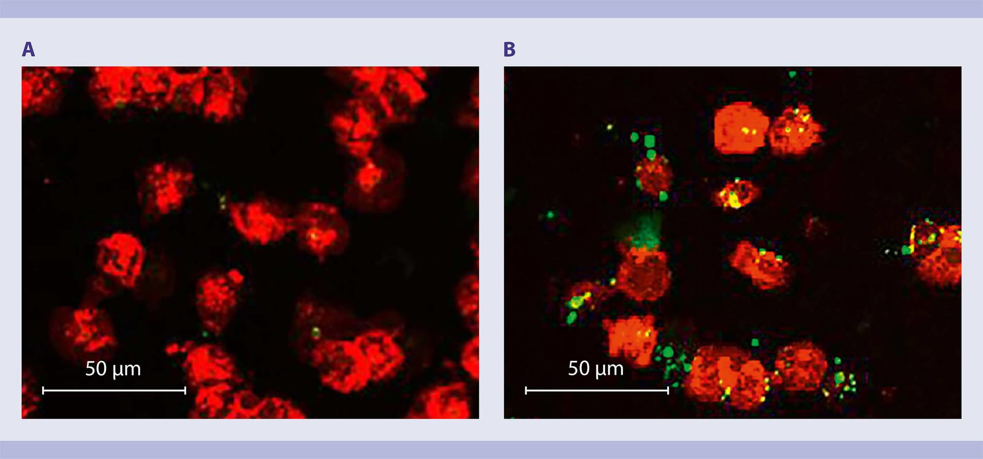 MACS® MicroBeads for magnetic cell isolation | Miltenyi Biotec | USA