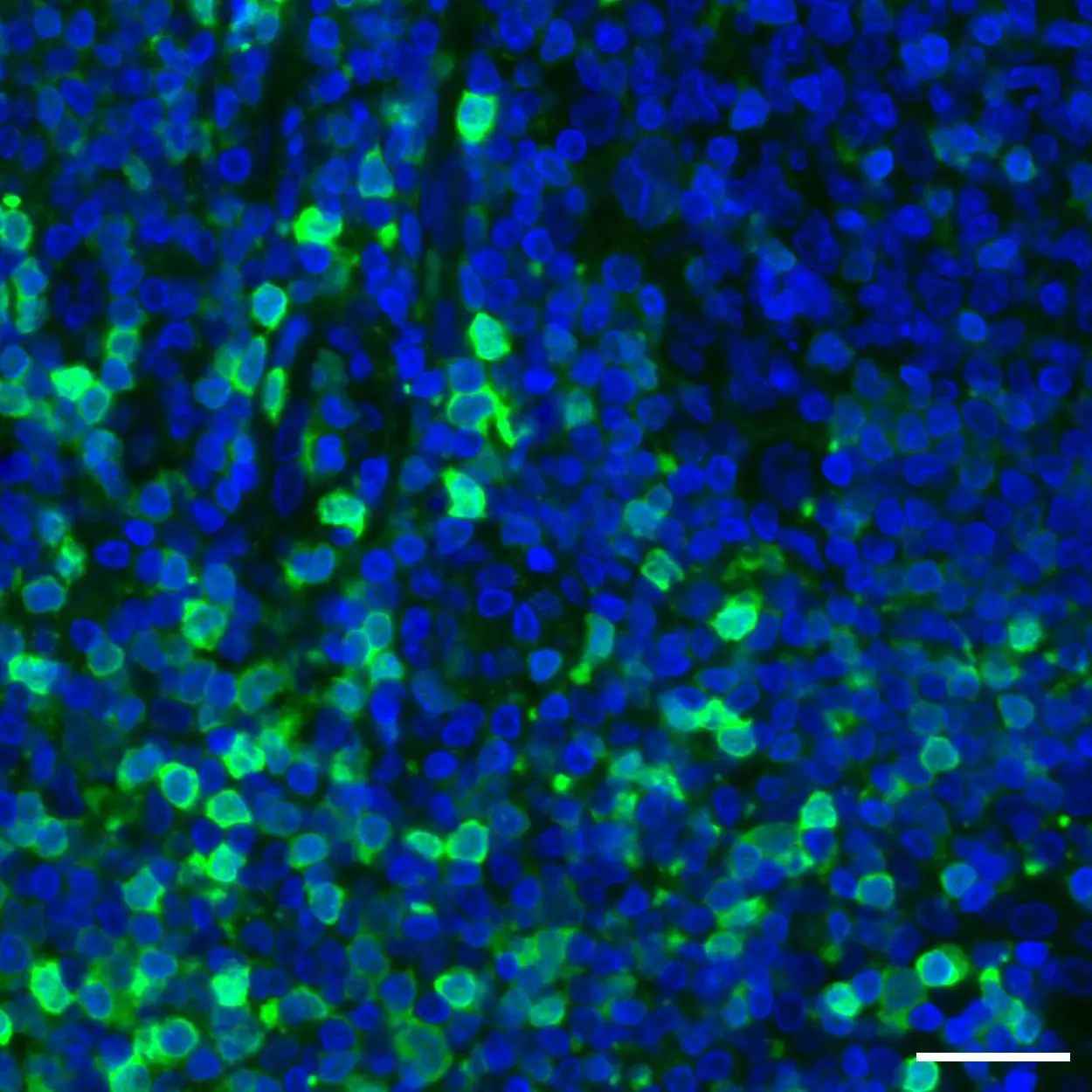 S100A4 Antibody, anti-human, REAdye_lease™ | Miltenyi Biotec | Great ...