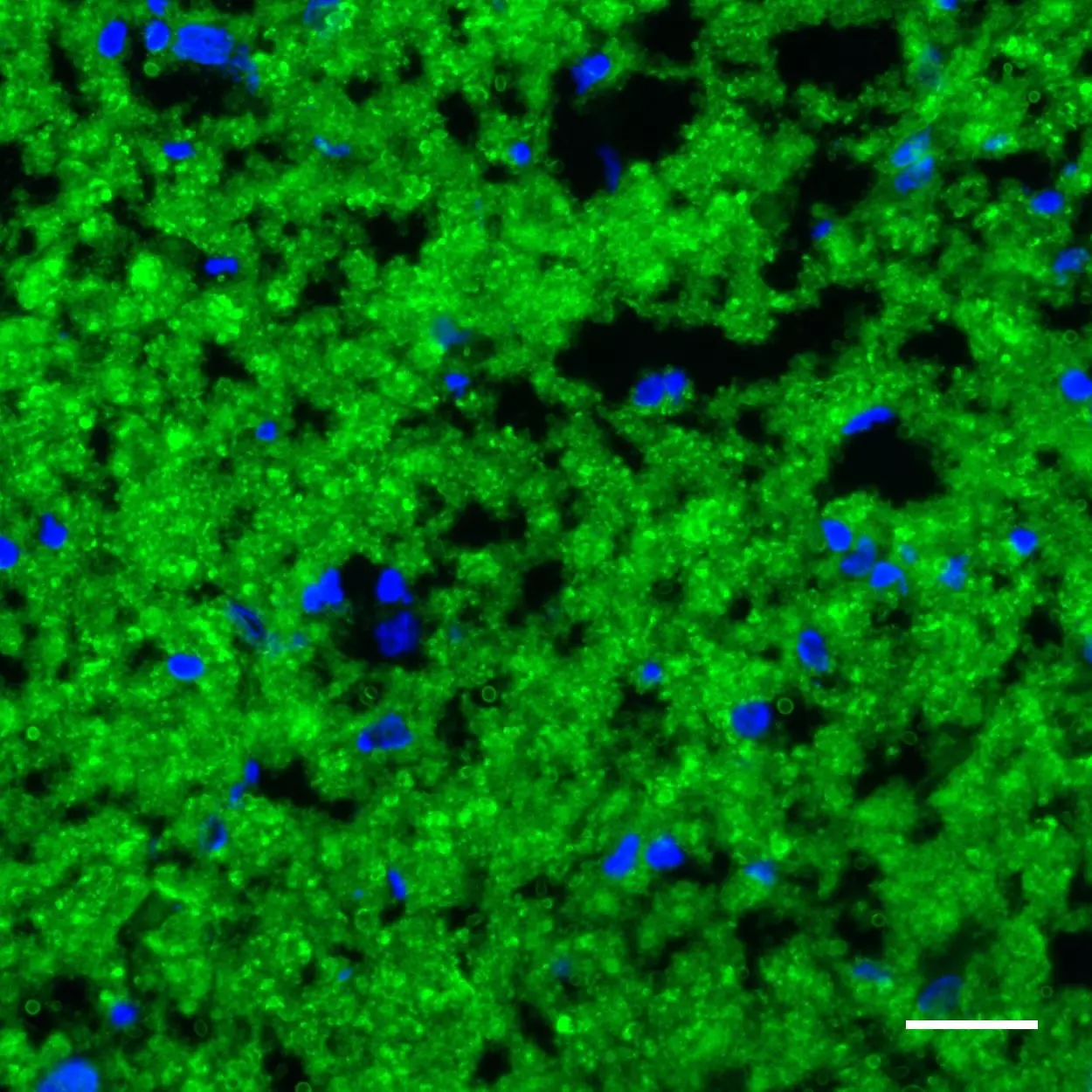 CD56 (NCAM1) Antibody, anti-human, REAdye_lease™ | Miltenyi Biotec | USA