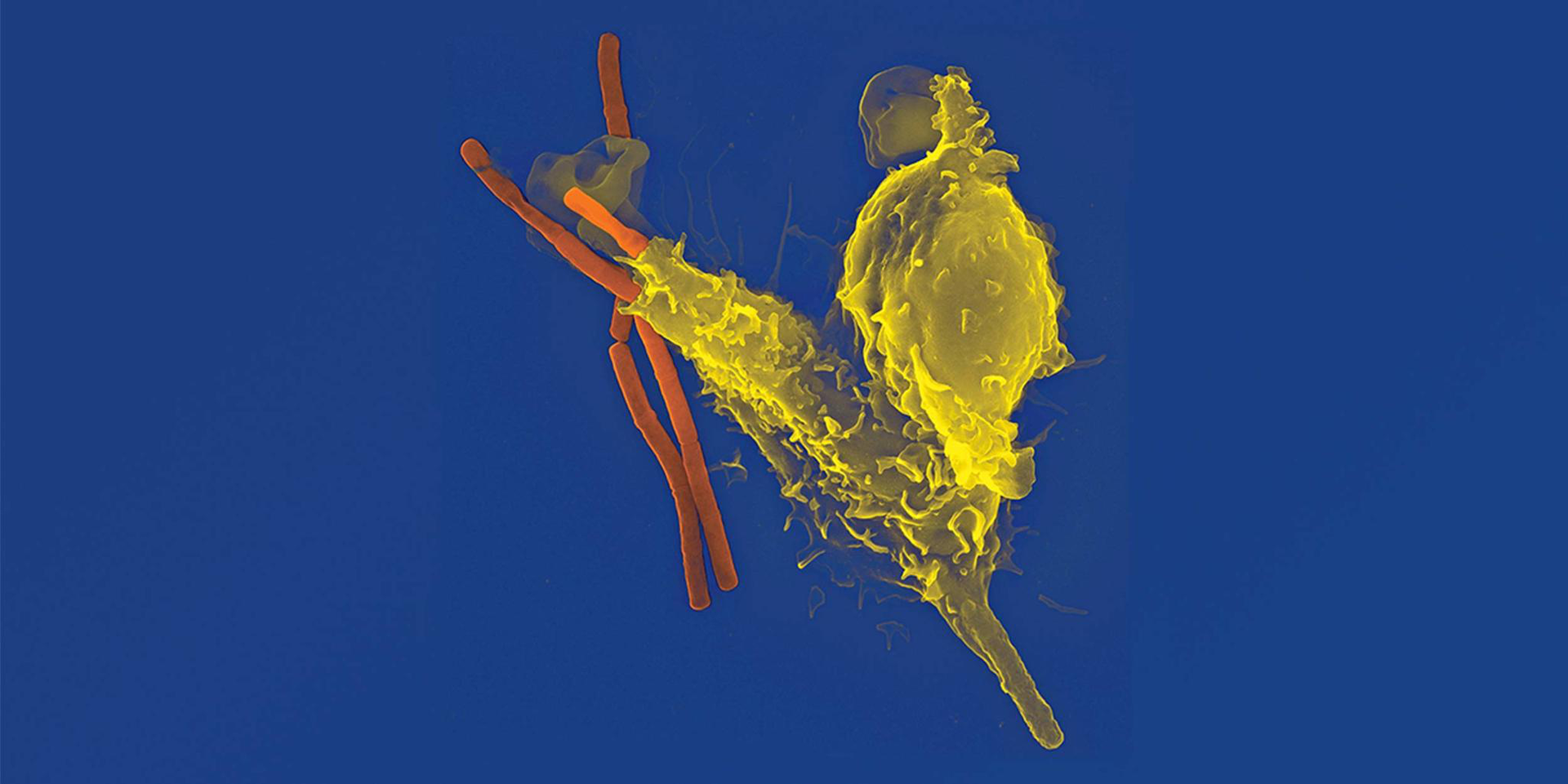 Granulocyte products | Cell isolation, culture and analysis | Miltenyi ...