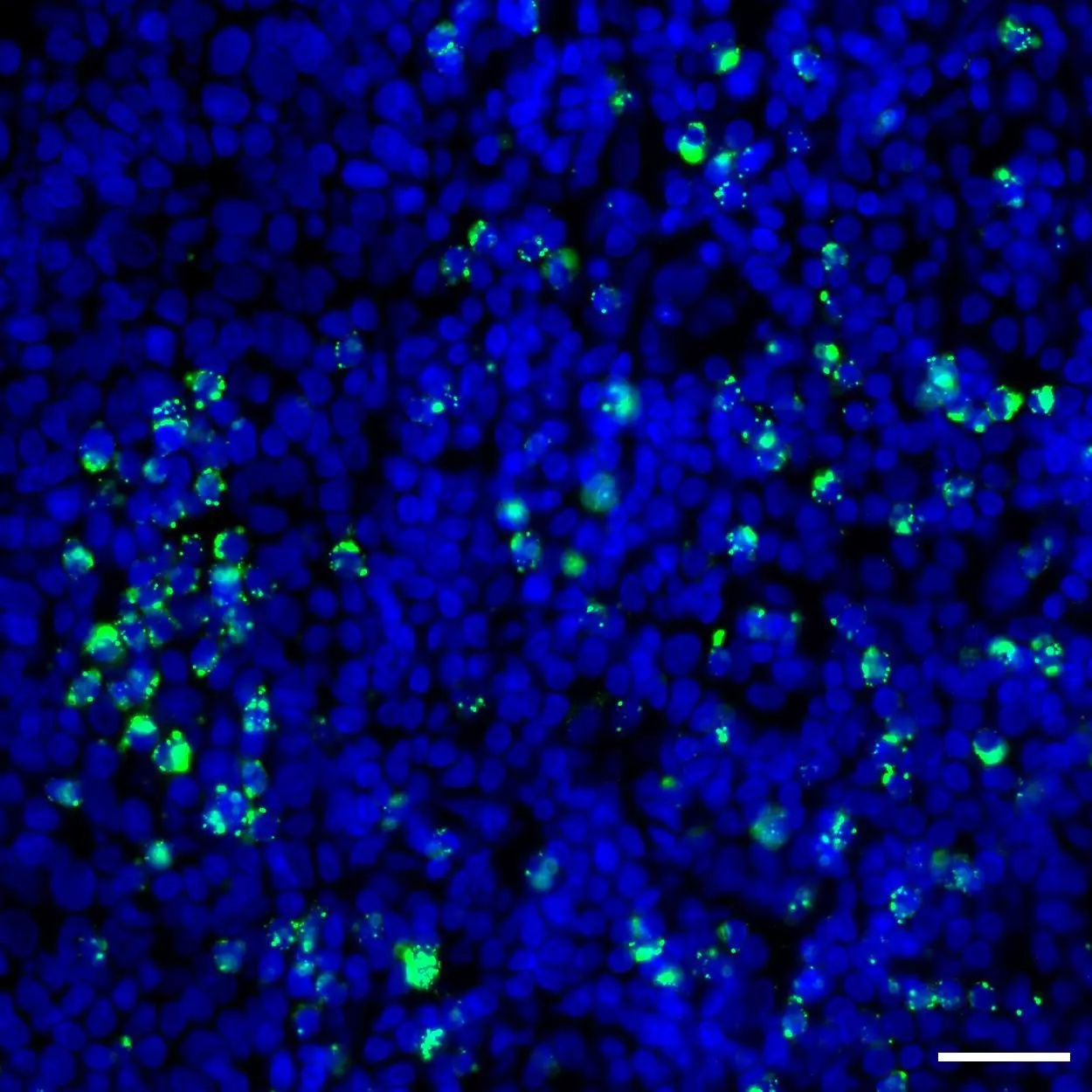 TIA1 Antibody, anti-human, REAdye_lease™ | Miltenyi Biotec | Australia