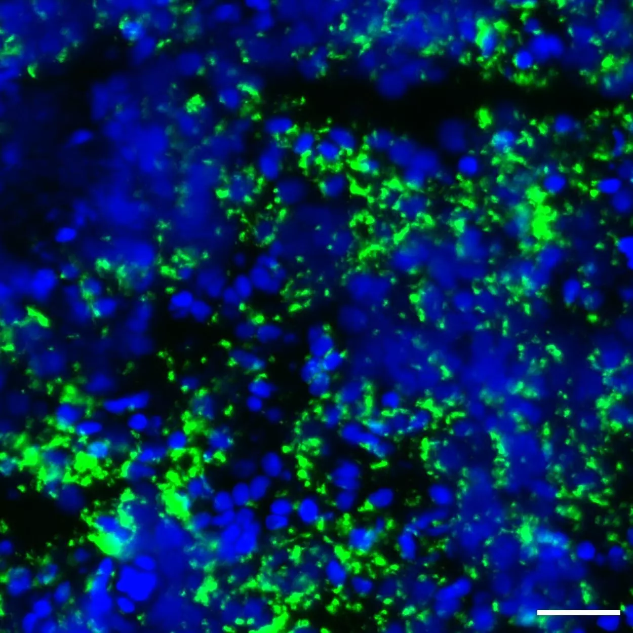 CD41/CD61 Antibody, anti-human, REAlease® | Miltenyi Biotec | USA