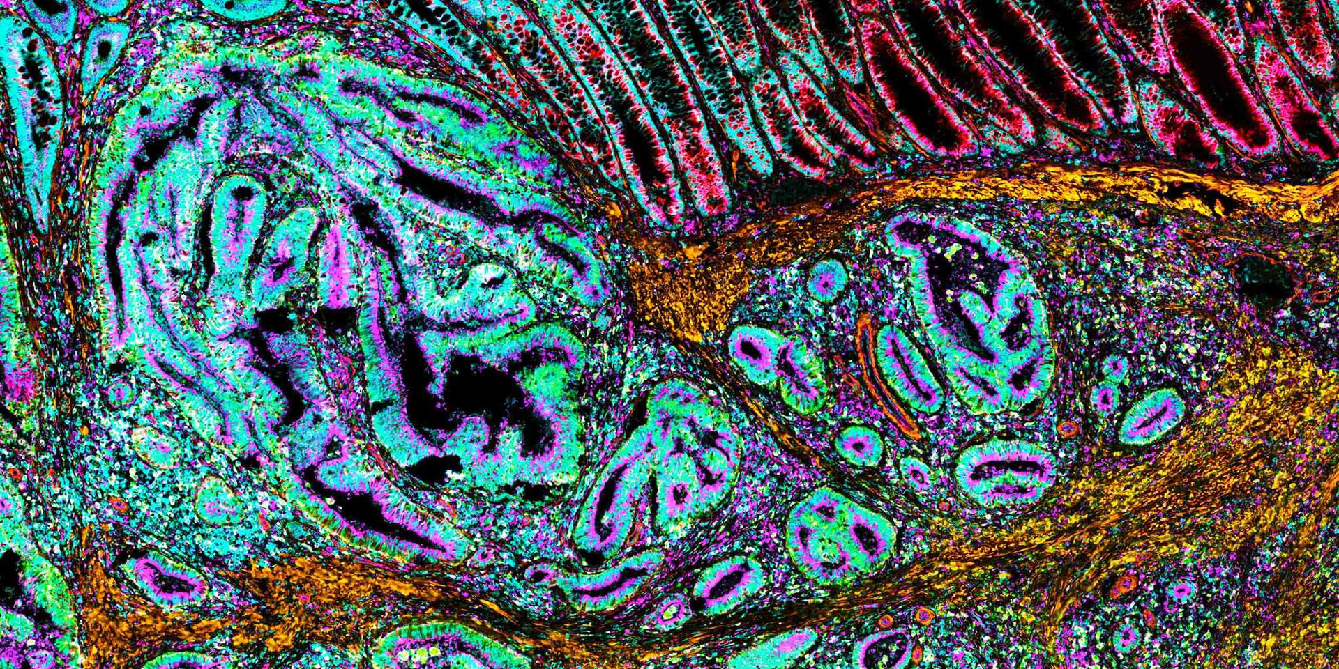 Spatial biology and imaging | Miltenyi Biotec | Great Britain
