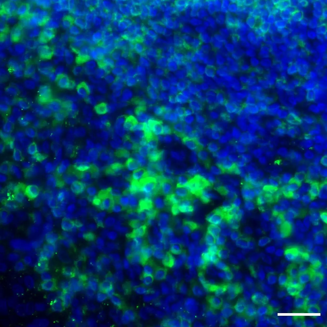 CD79a Antibody, anti-human, REAfinity™ | Miltenyi Biotec | USA