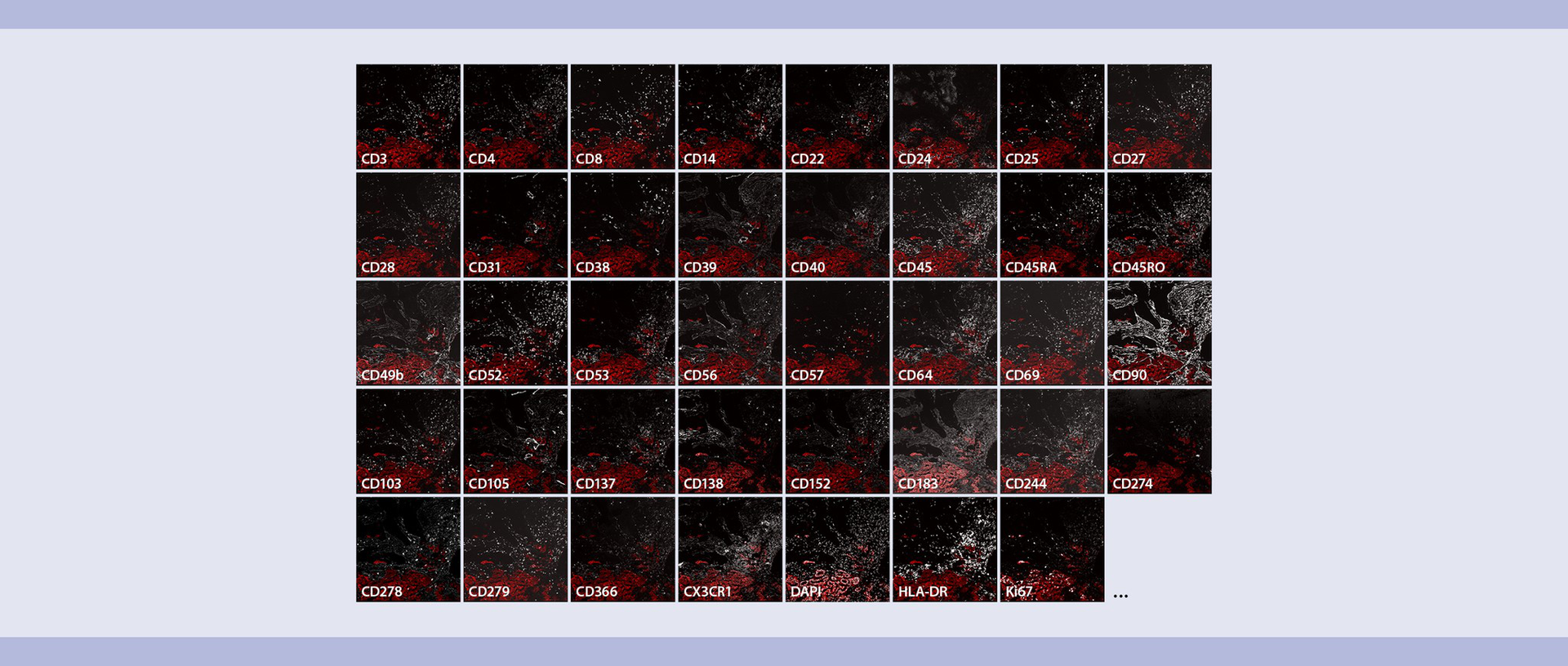 Tumor infiltrating leukocytes | Til isolation | Miltenyi | Miltenyi ...