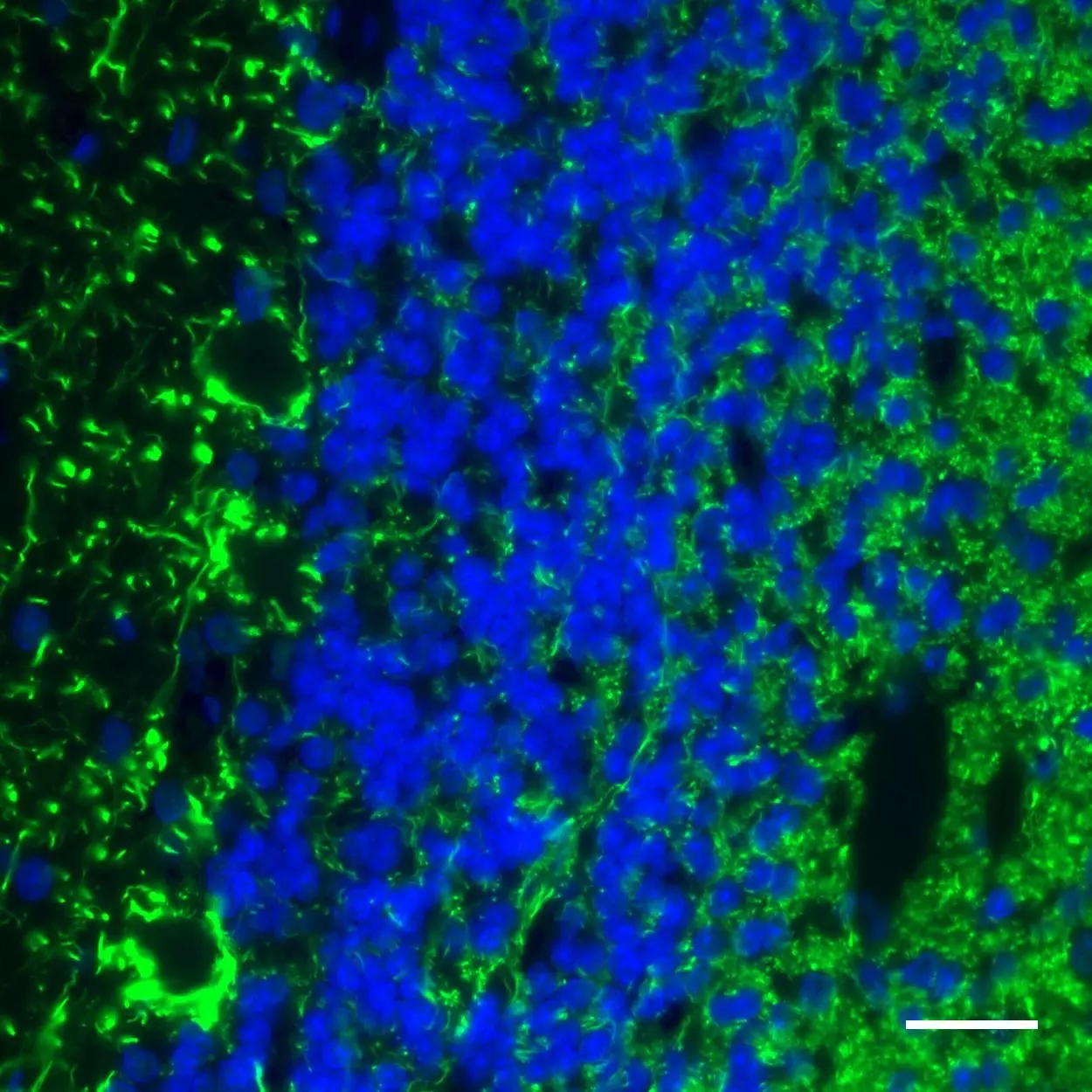 Neurofilament H (200 kD) Antibody, anti-human/mouse, REAdye_lease ...