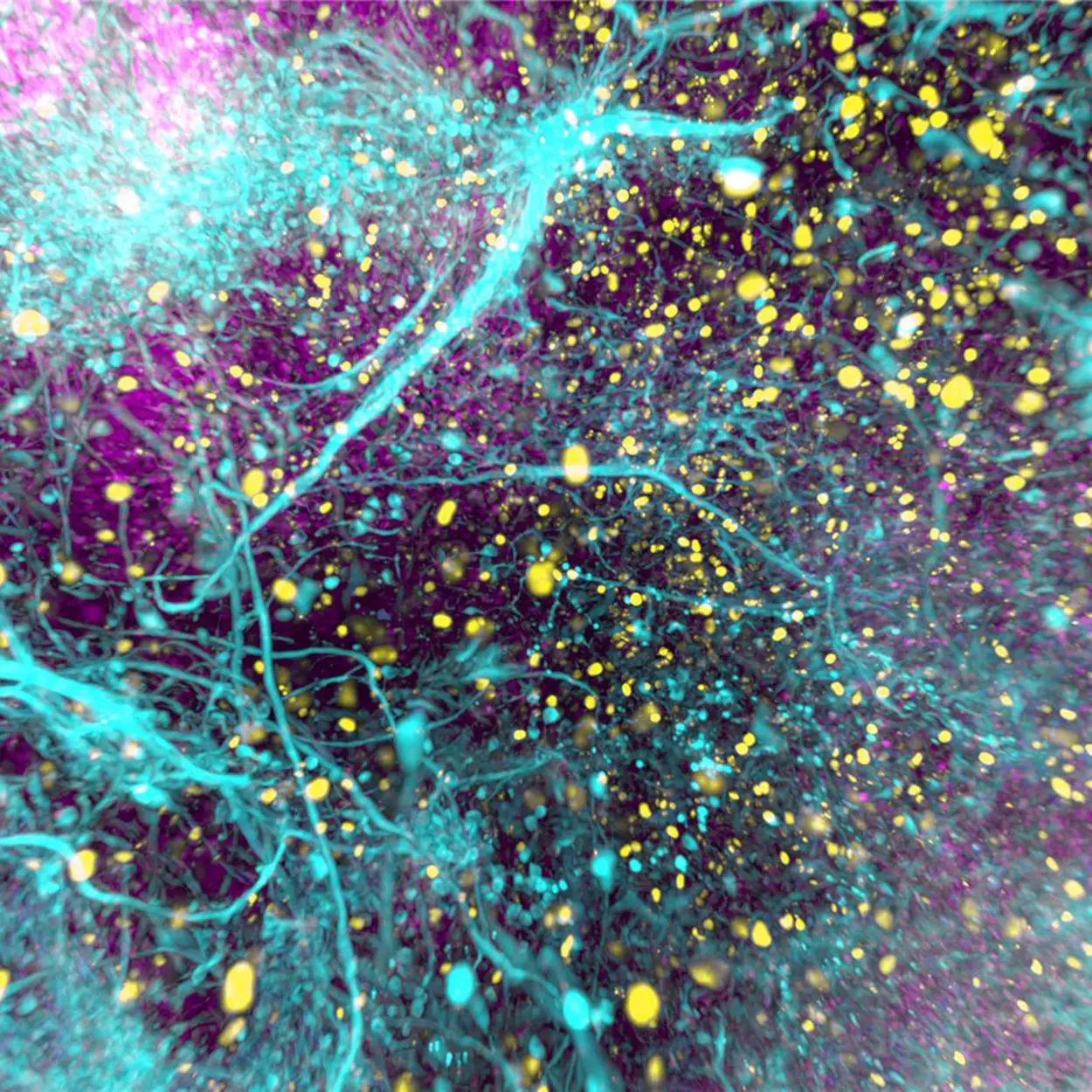 Light sheet microscope | UltraMicroscope Platform | Visualizing complex ...