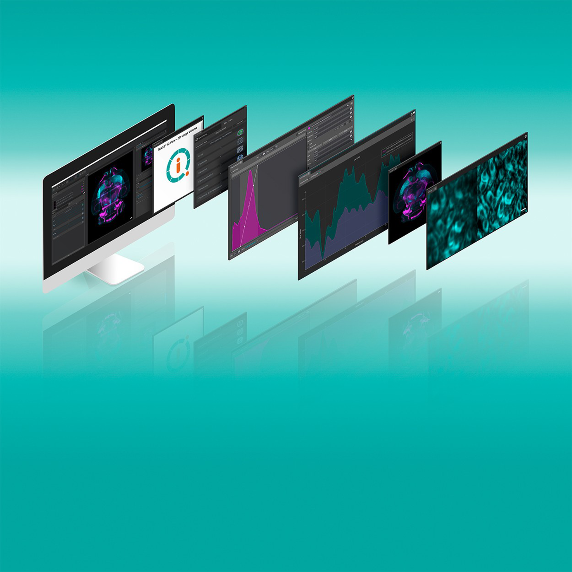 Light sheet microscopy | UltraMicroscope Platform | Visualizing complex ...
