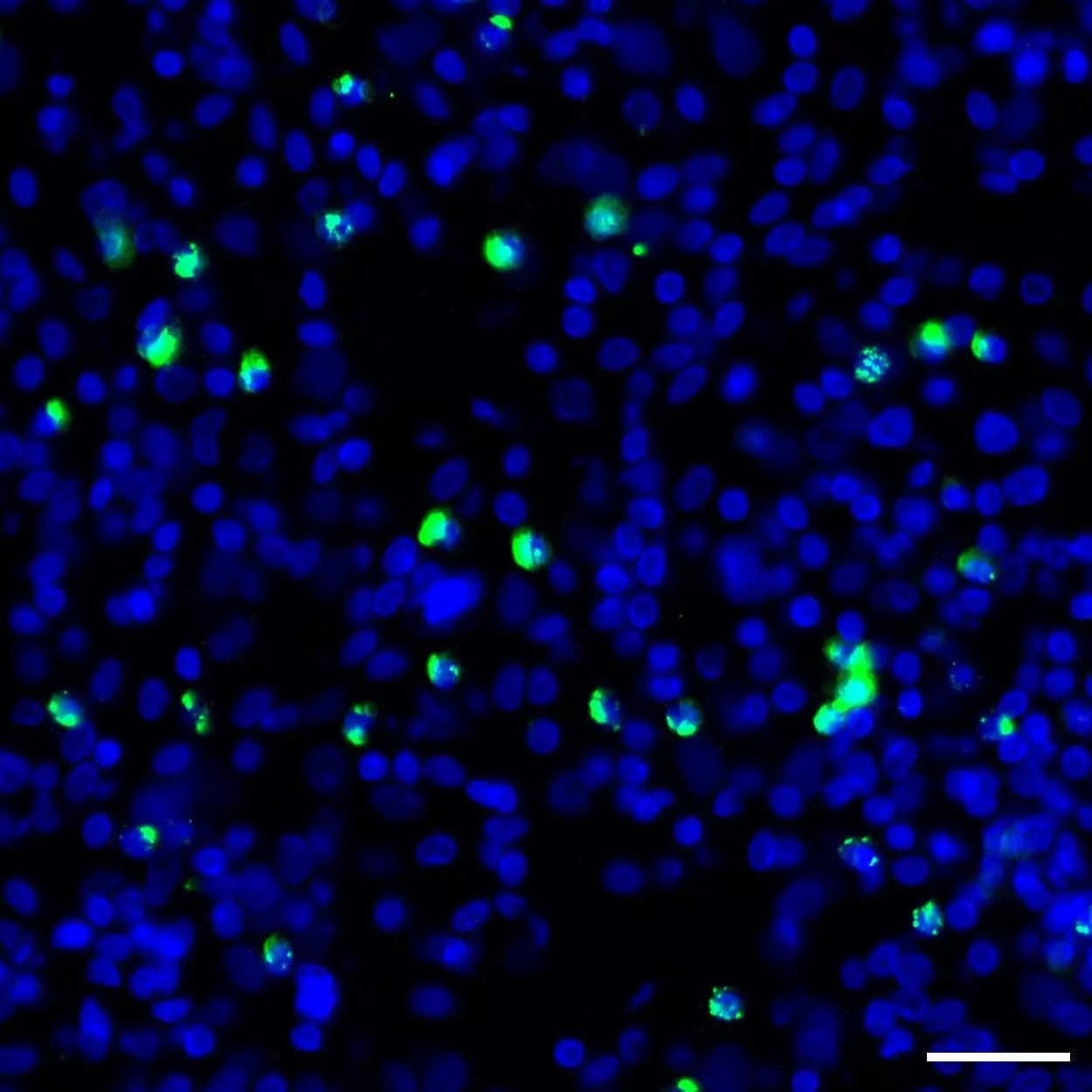 Perforin Antibody, anti-human, REAdye_lease™ | Miltenyi Biotec | Great ...