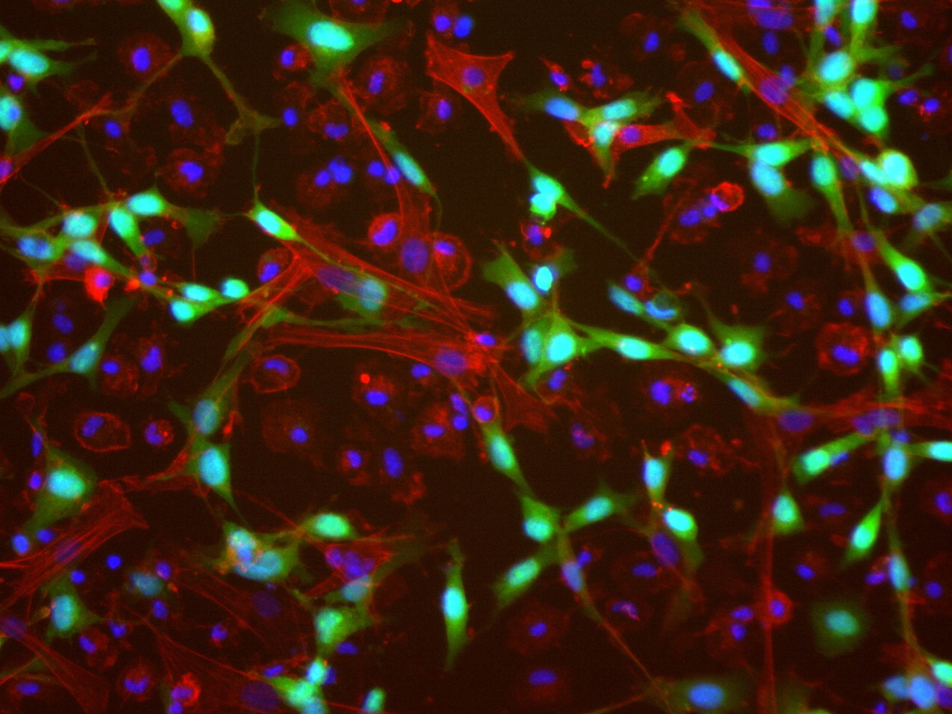 Tumor cells (mouse) | Miltenyi Biotec | 日本