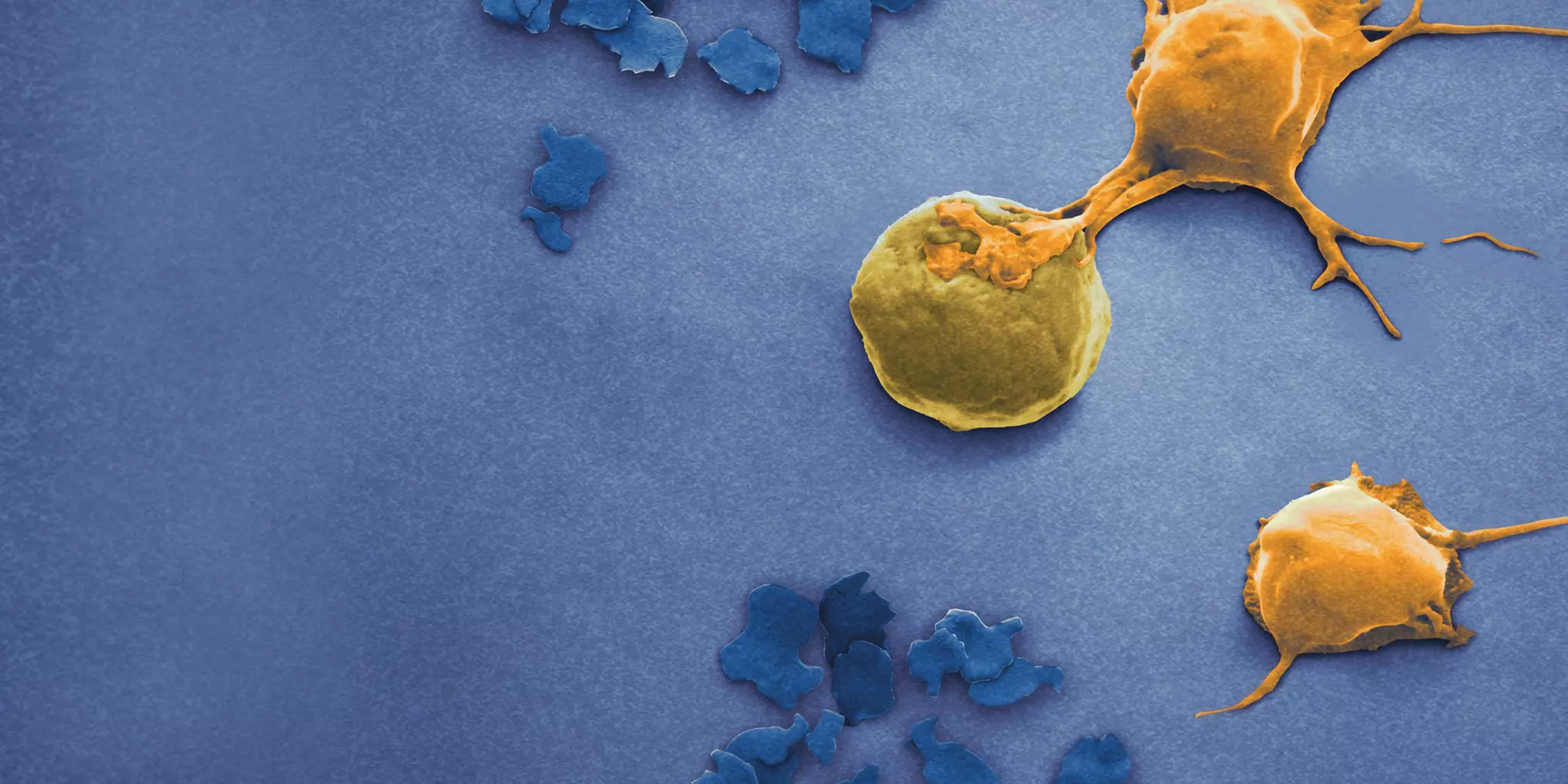 NK Cell Products | Cell isolation, culture and analysis | Miltenyi ...