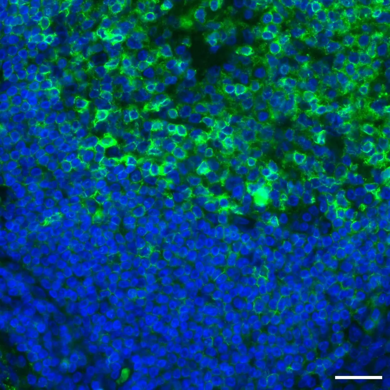 CD45 Antibody, anti-human, REAdye_lease™ | Miltenyi Biotec | India